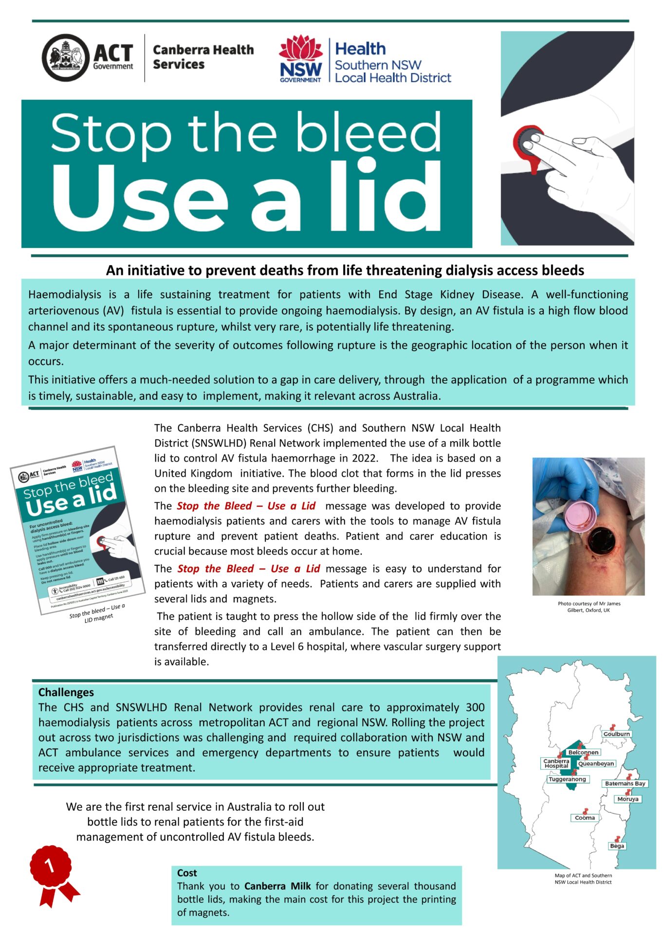 Stop the bleed - use a lid. An initiative to prevent deaths from life ...